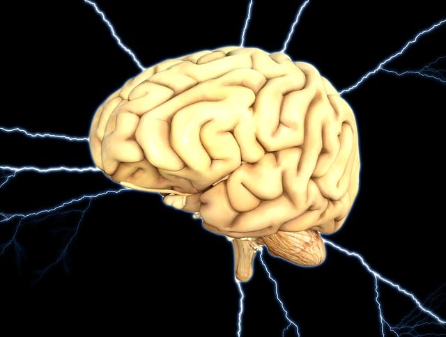 How to look after your brain! - Life Improvement Boot Camp How to look after your brain! - Life Improvement Boot Camp